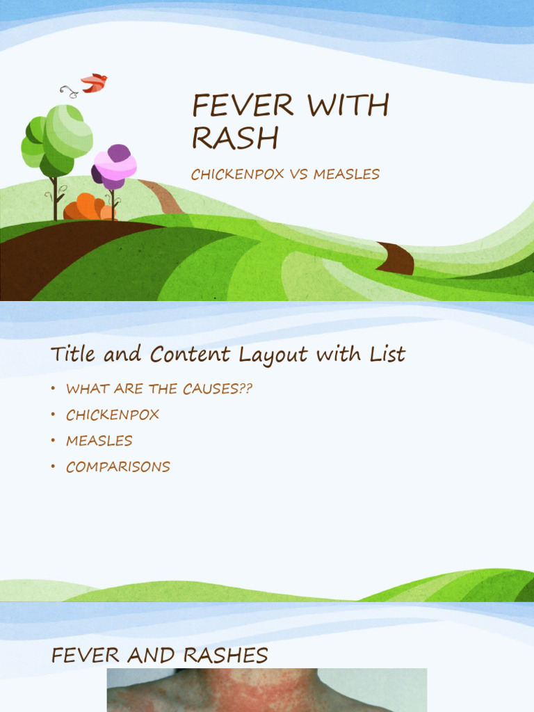 FEVER WITH RASH | PDF
