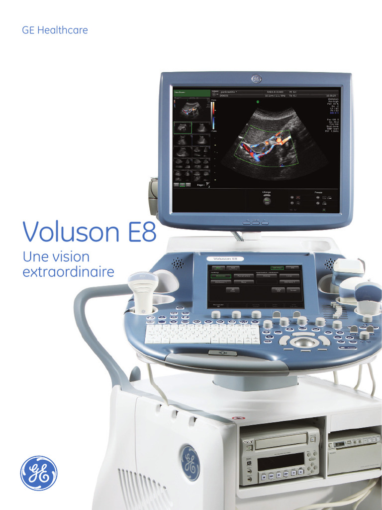 VOLUSON E8 Brochure Français | PDF