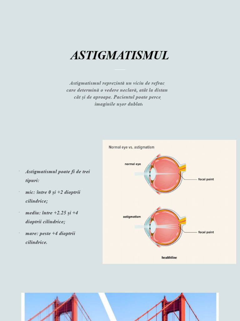 Astigmatismul | PDF