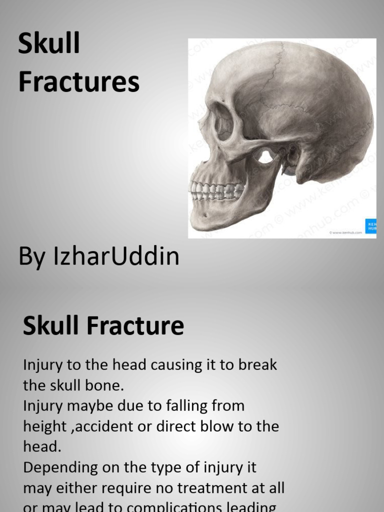 skull fractures | PDF