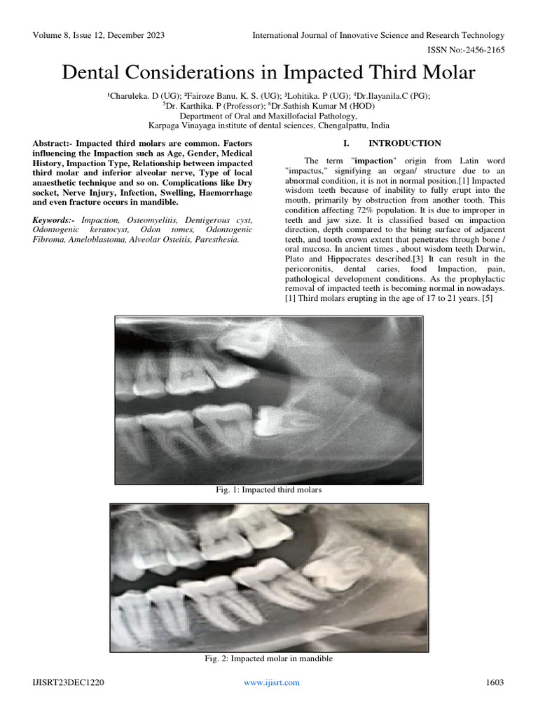 Dental Considerations in Impacted Third Molar | PDF | Epithelium ...