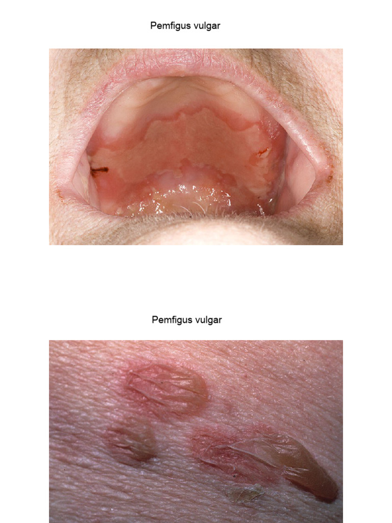 Imagini Dermato DeScRise Demential | PDF