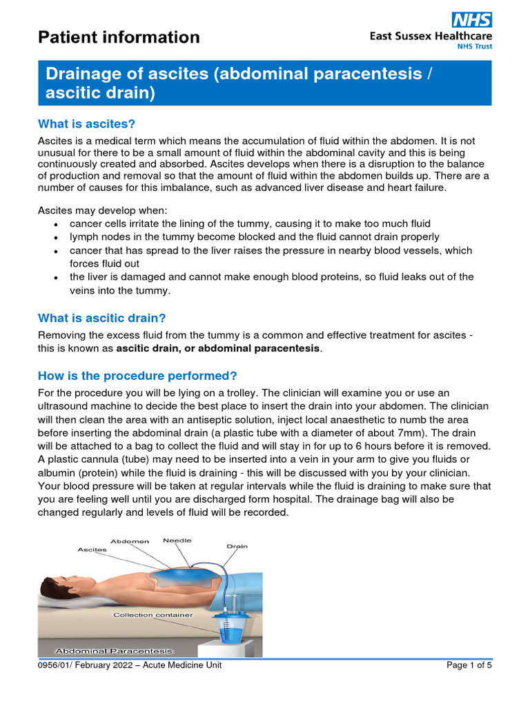 Drainage of Ascites (Abdominal Paracentesis / Ascitic Drain) | PDF