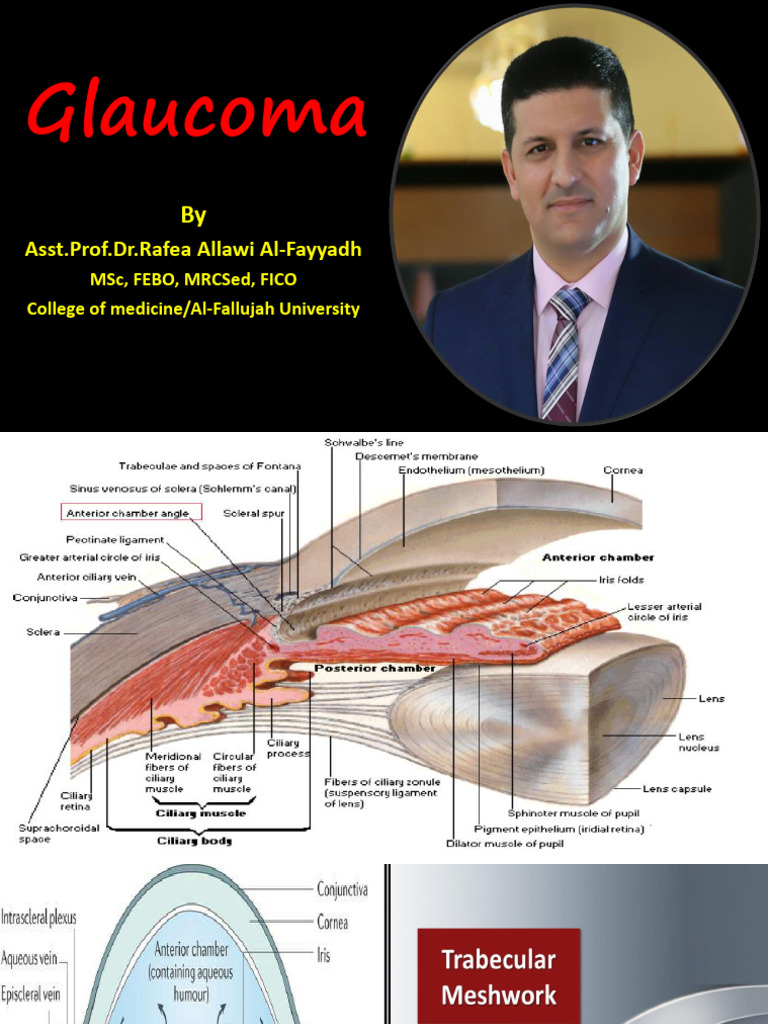 вљєпёџ6 Glaucoma Pdf Glaucoma Clinical Medicine