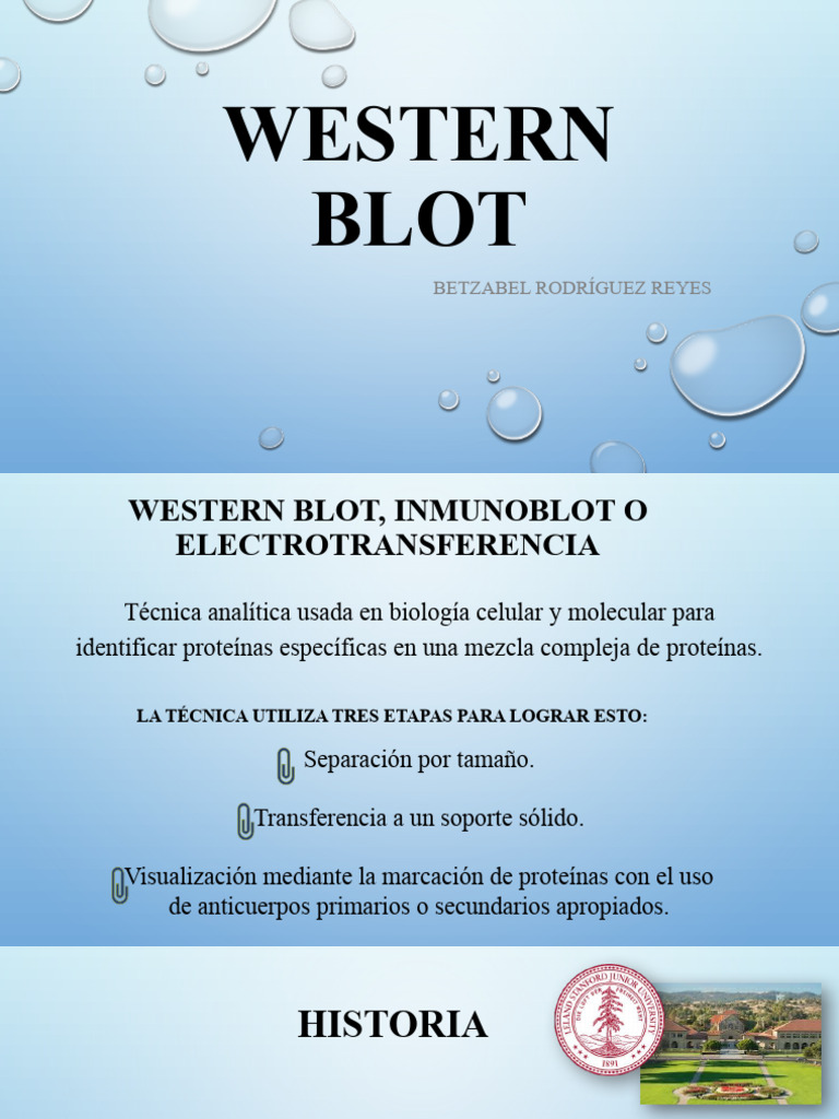 Western Blot | PDF