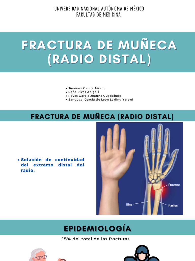 Fractura de Muñeca | Descargar gratis PDF | Sistema musculoesquelético ...