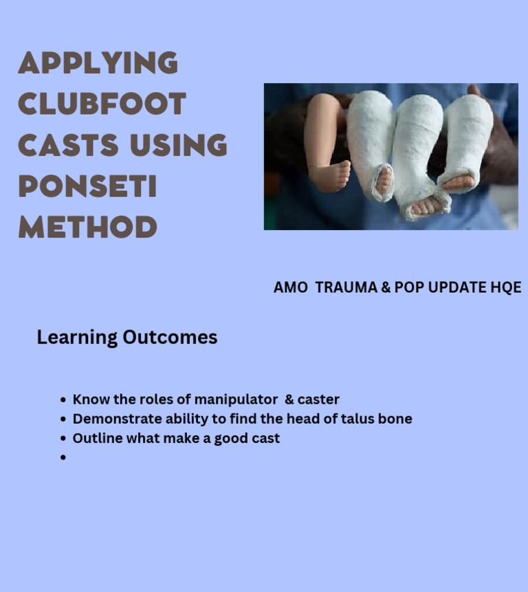 Applying Clubfoot Casts Using Ponseti Method | PDF