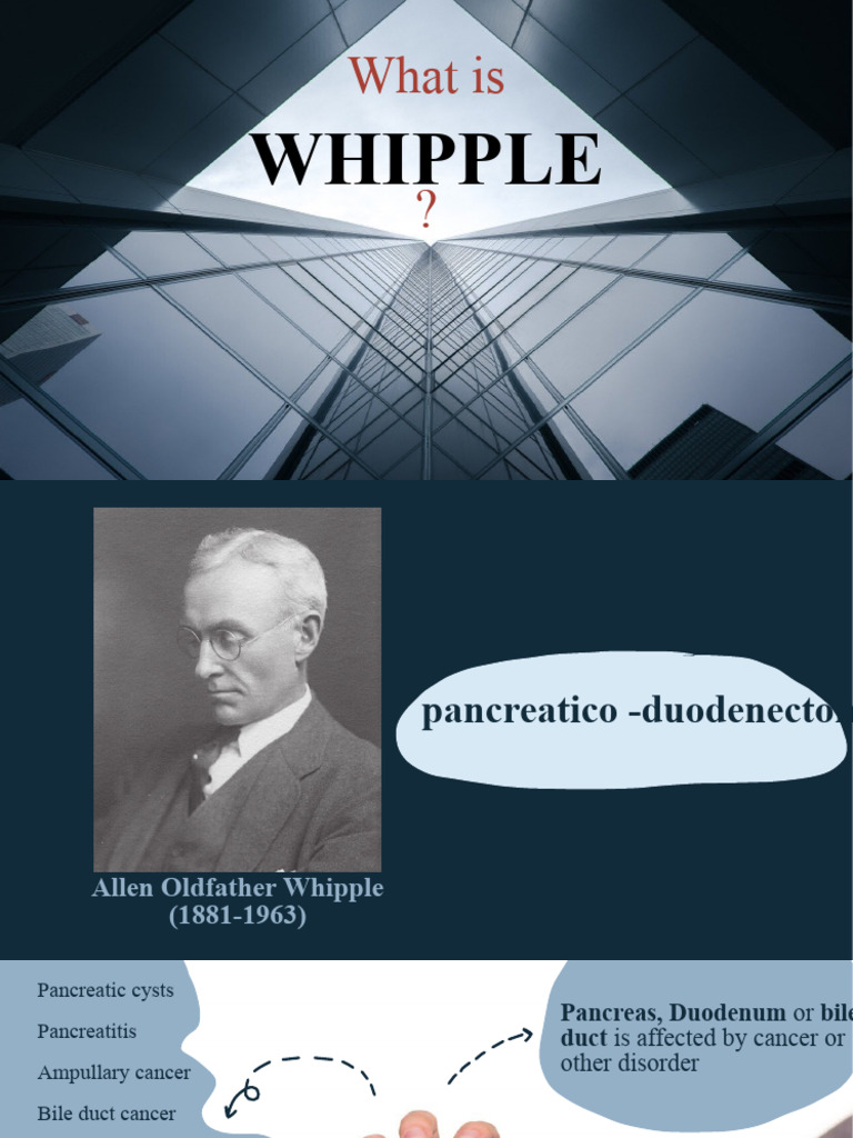WHIPPLE | PDF