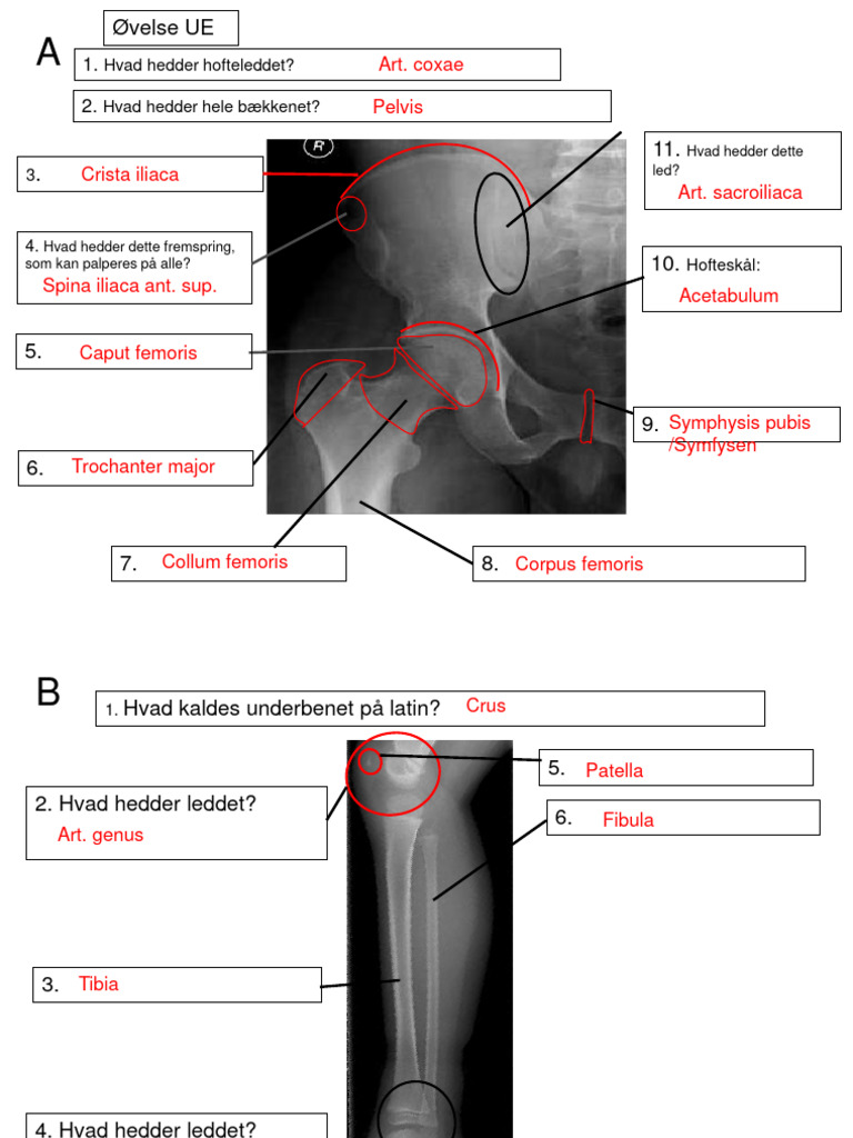 SVAR Øvelse RTG - Billeder UE RLIN | PDF