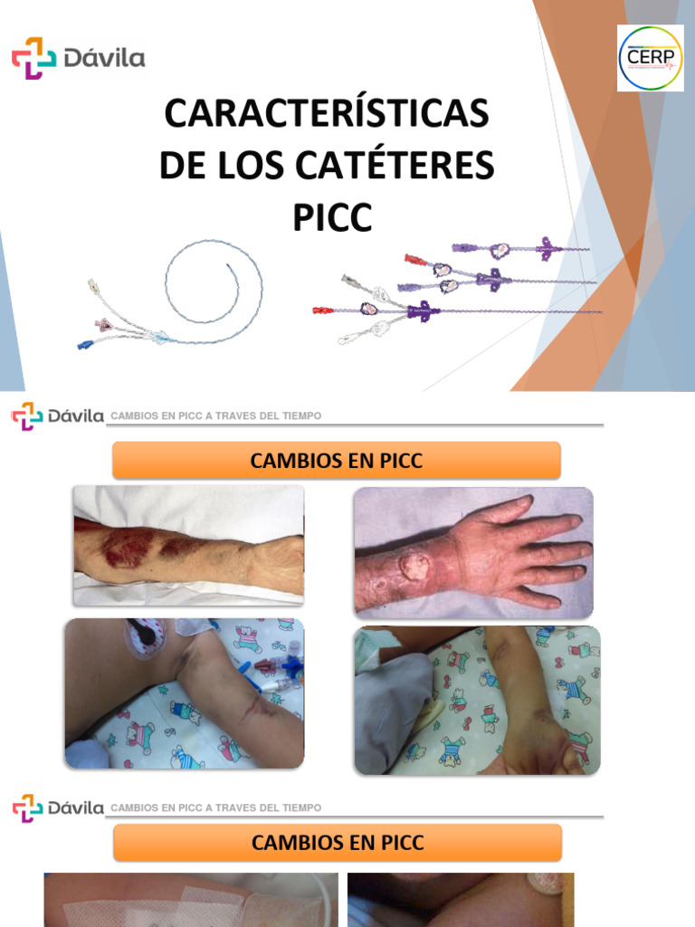 Caracteristicas Picc Camila. Actualizada - Compressed | PDF