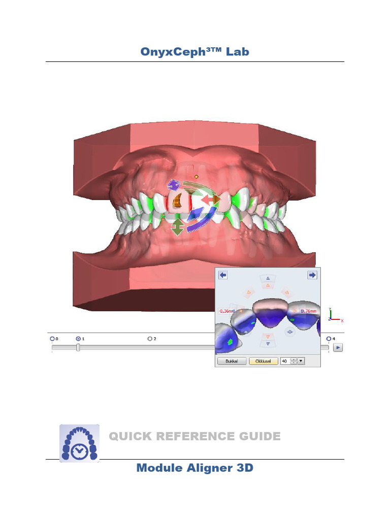 3D Workflow Aligner3d EN | PDF | Icon (Computing) | Tooth