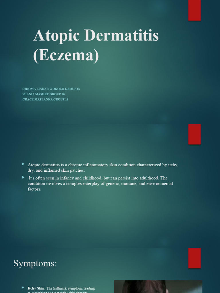 Atopic Dermatitis Nursing School (Eczema) | PDF | Dermatitis | Causes ...