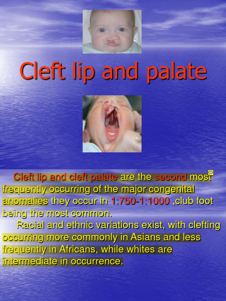 Cleft Lip and Cleft Palate | Download Free PDF | Face | Facial Features