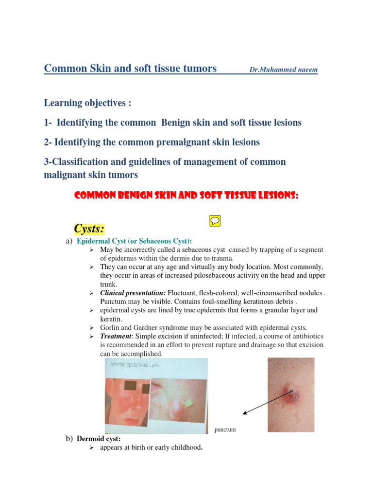 Common Skin Tumors: Identification & Management | PDF