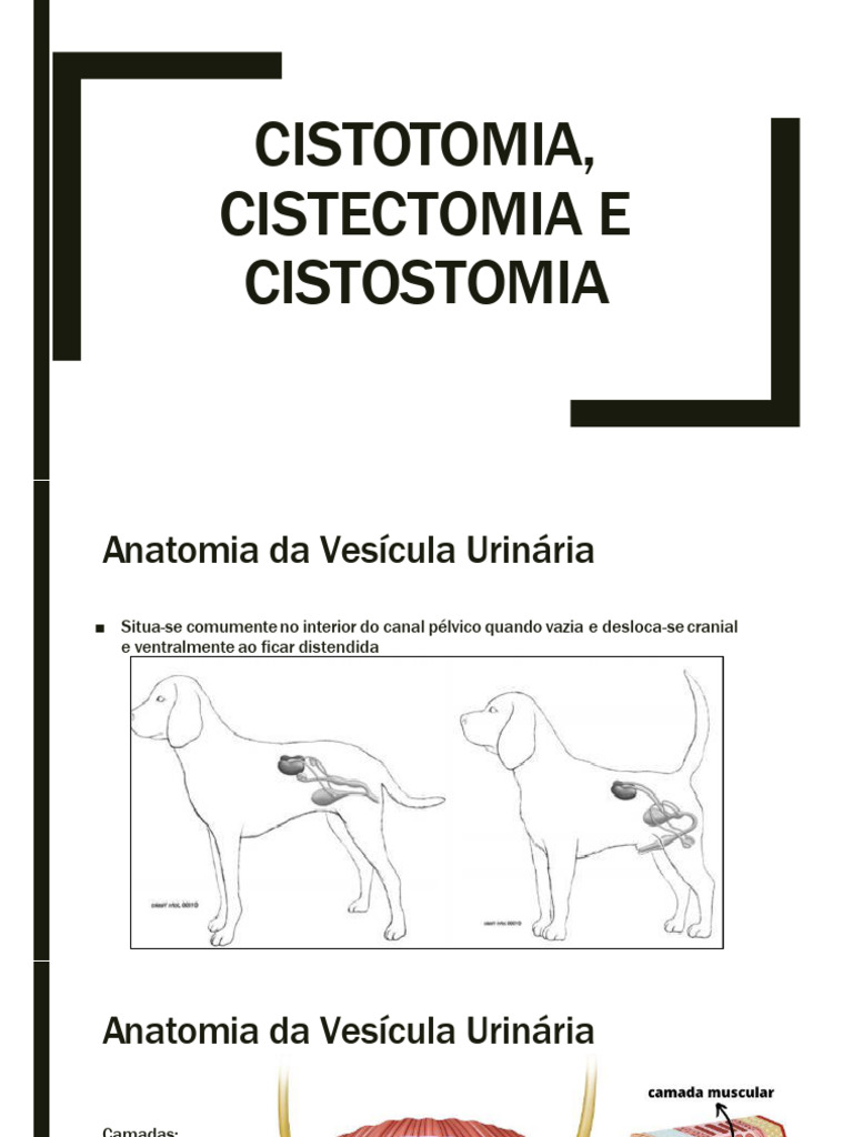 Cistotomia, Cistectomia e Cistostomia | PDF