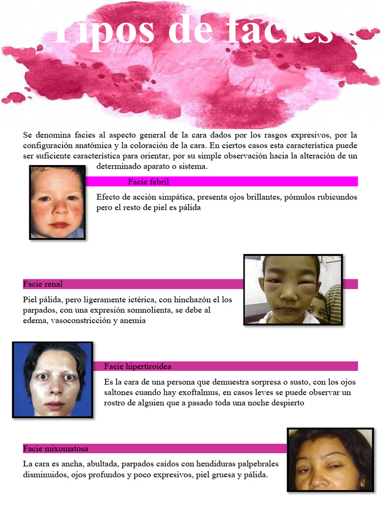 Tipos de Facies | PDF