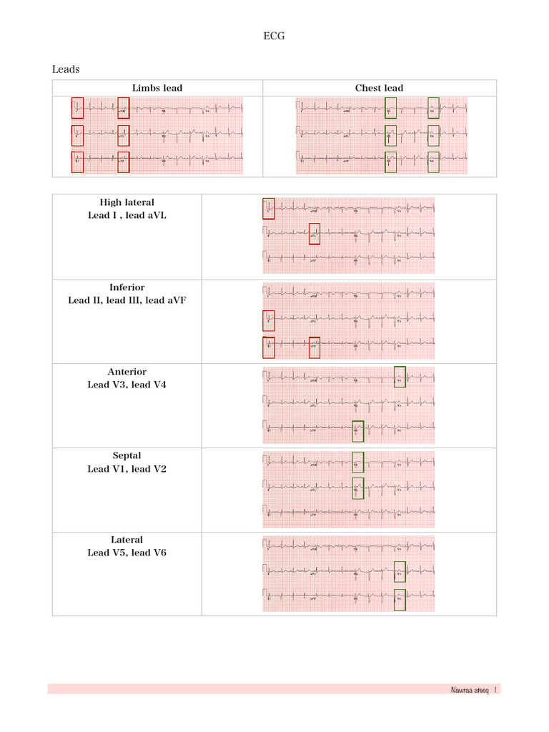 ECG Notes | PDF | Electrocardiography | Medical Specialties