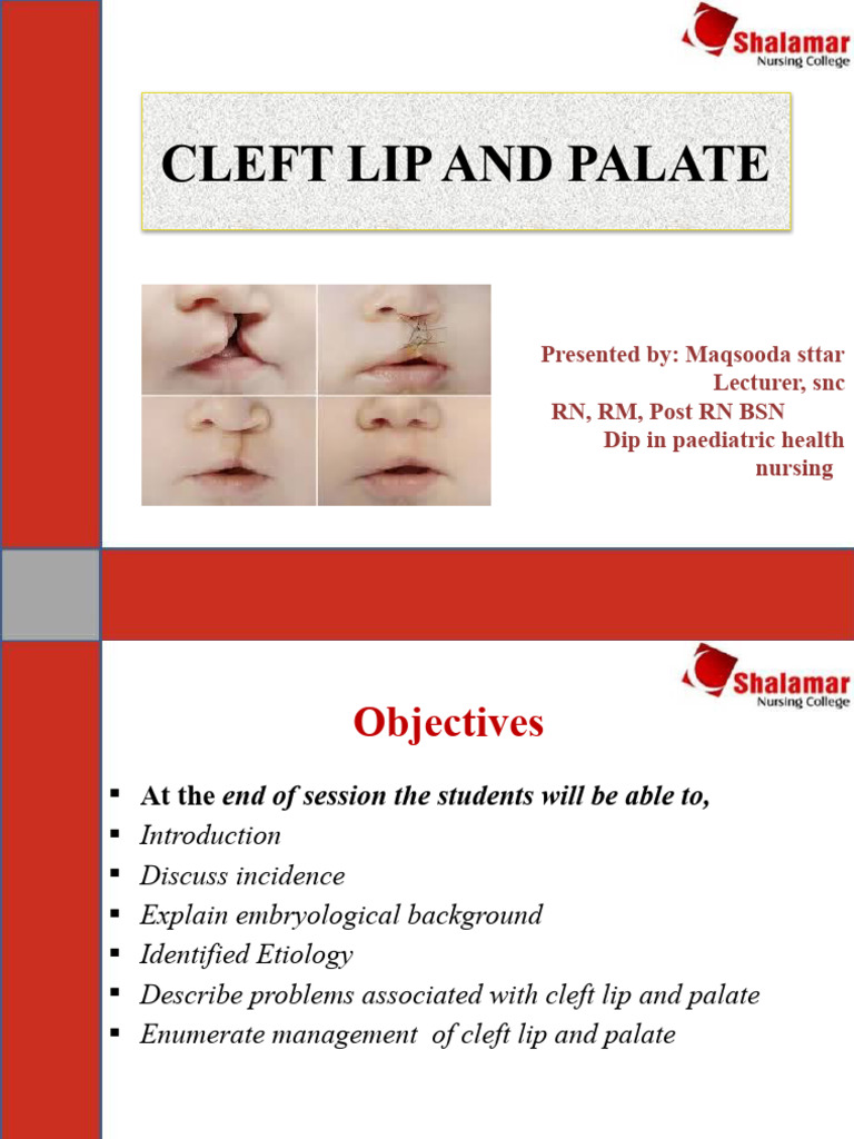 15.3 Cleft Lip and Palate | PDF | Breastfeeding | Medical Specialties
