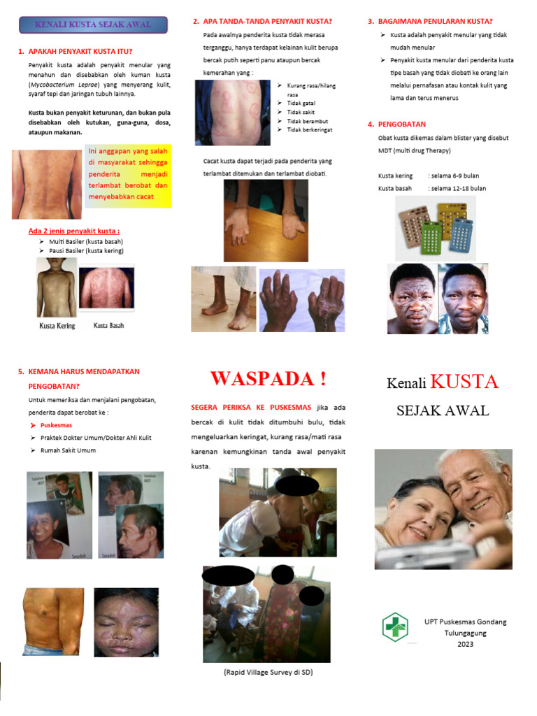 Leaflet Kusta | PDF
