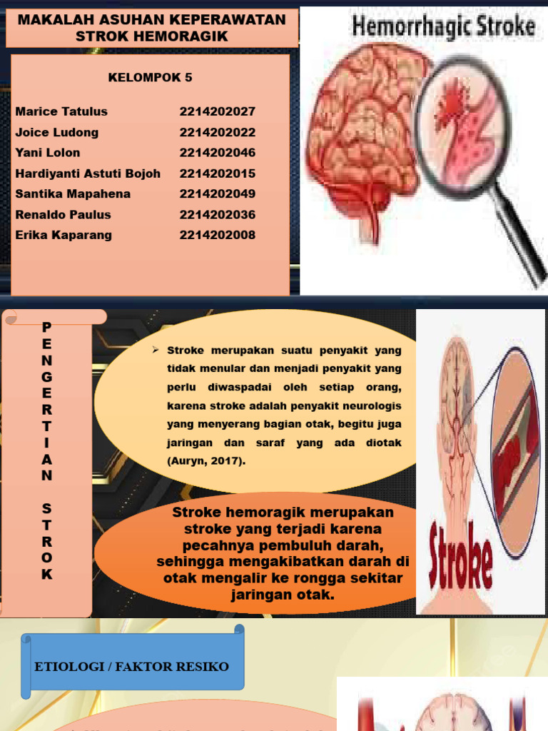 Stroke Hemoragic | PDF