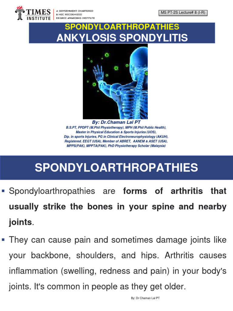 Ankylosing Spondylitis Overview | PDF
