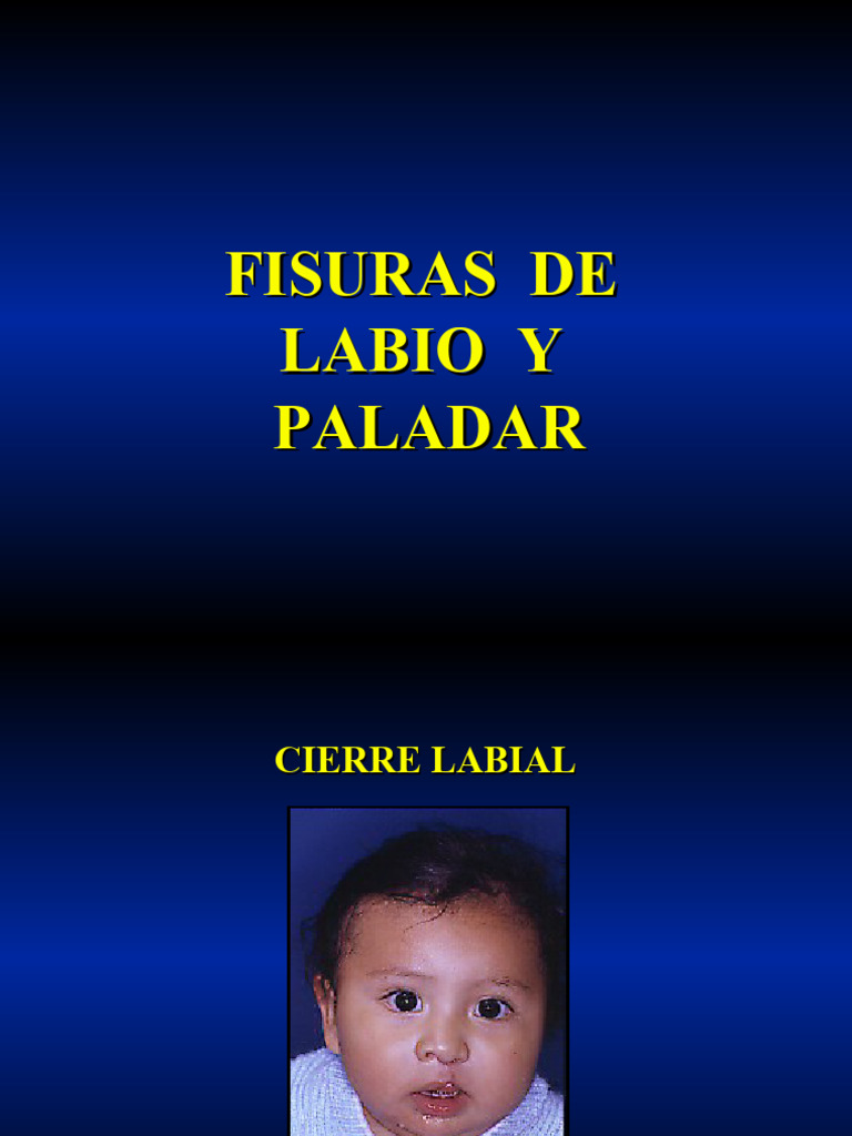 Cirugias en El Labio y Paldar Hendido | PDF | Ortodoncia | Odontología