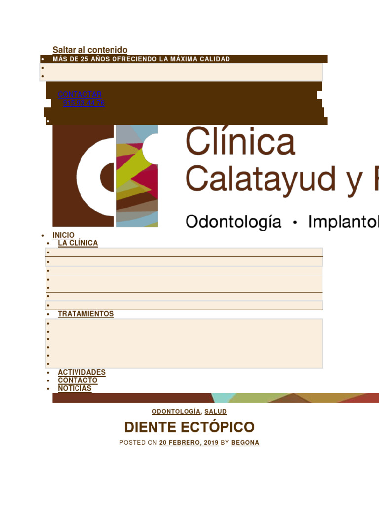 Dientes Ectopicos e Incluidos | PDF