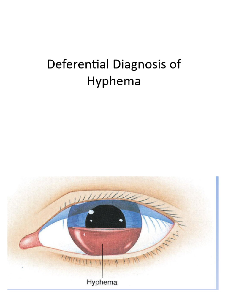 Hyphema Differentials | PDF | Clinical Medicine | Vision