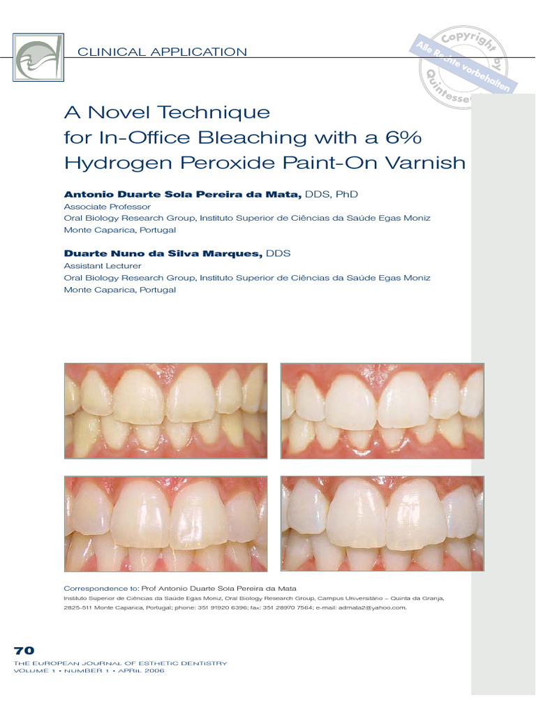 A Novel Technique For in Office Bleaching With A 6% Hydrogen Peroxide ...