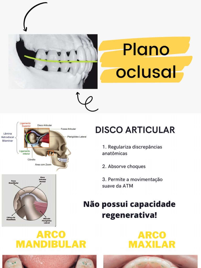 Plano Oclusal | PDF
