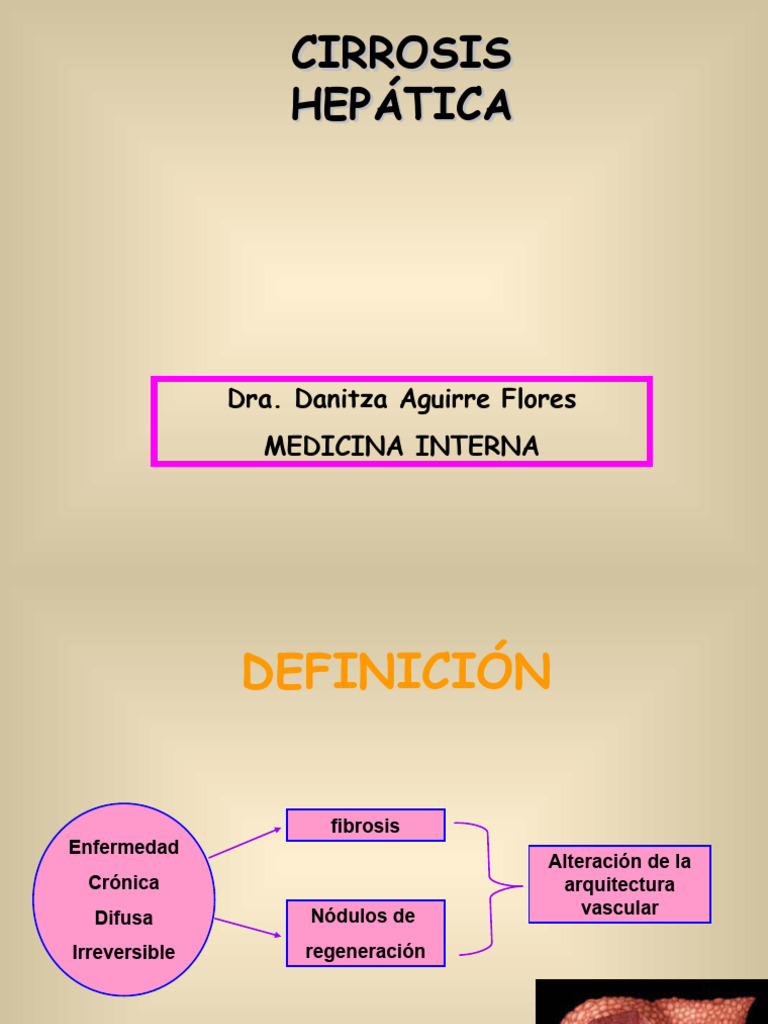 Fdocuments - Ec - Cirrosis Hepatica y Complicaciones | PDF