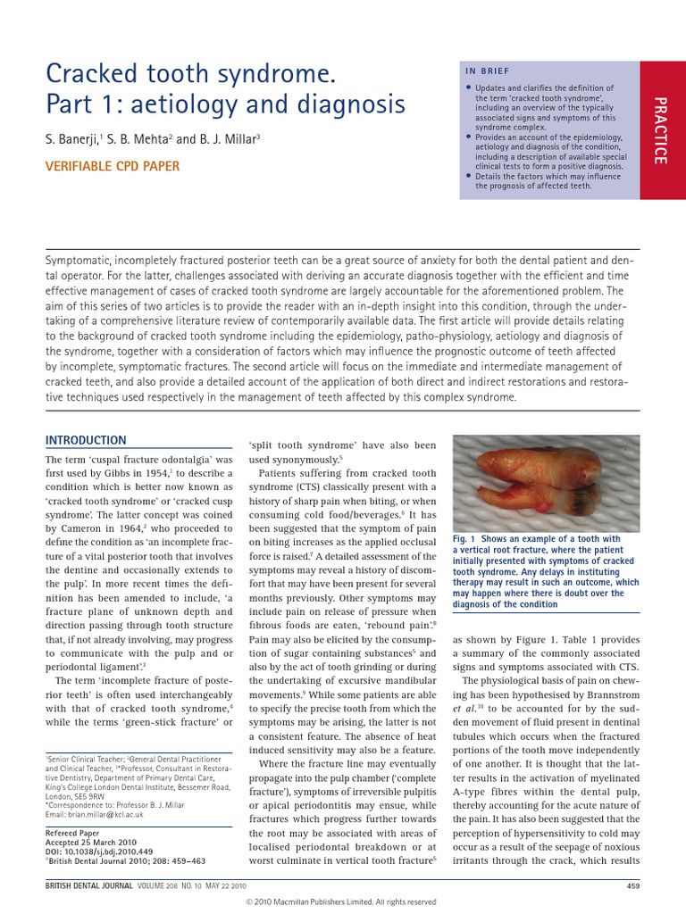 Cracked Tooth Syndrome. Part 1 Aetiology and Diagnosis | PDF | Health ...
