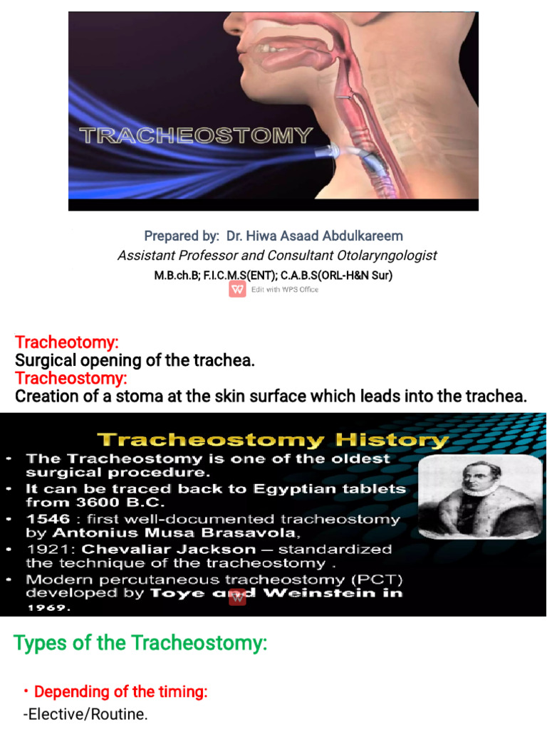 Tracheotomy: Types and Management | PDF