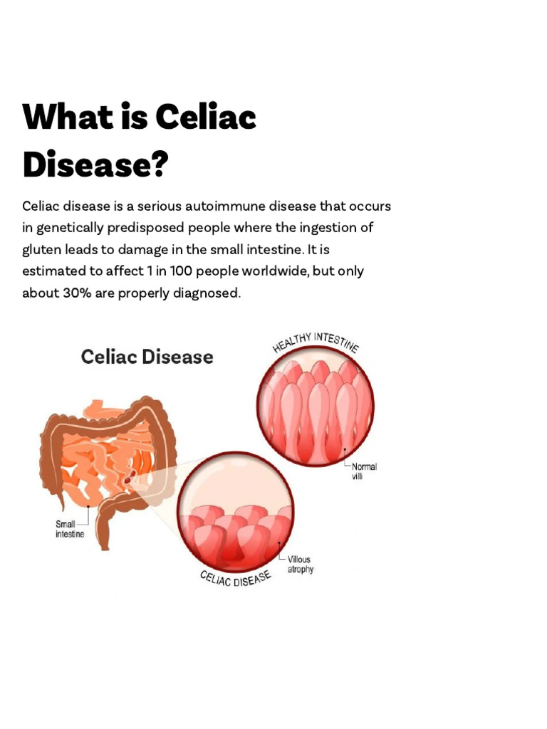 What is Celiac Disease_ _ Celiac Disease Foundation | PDF