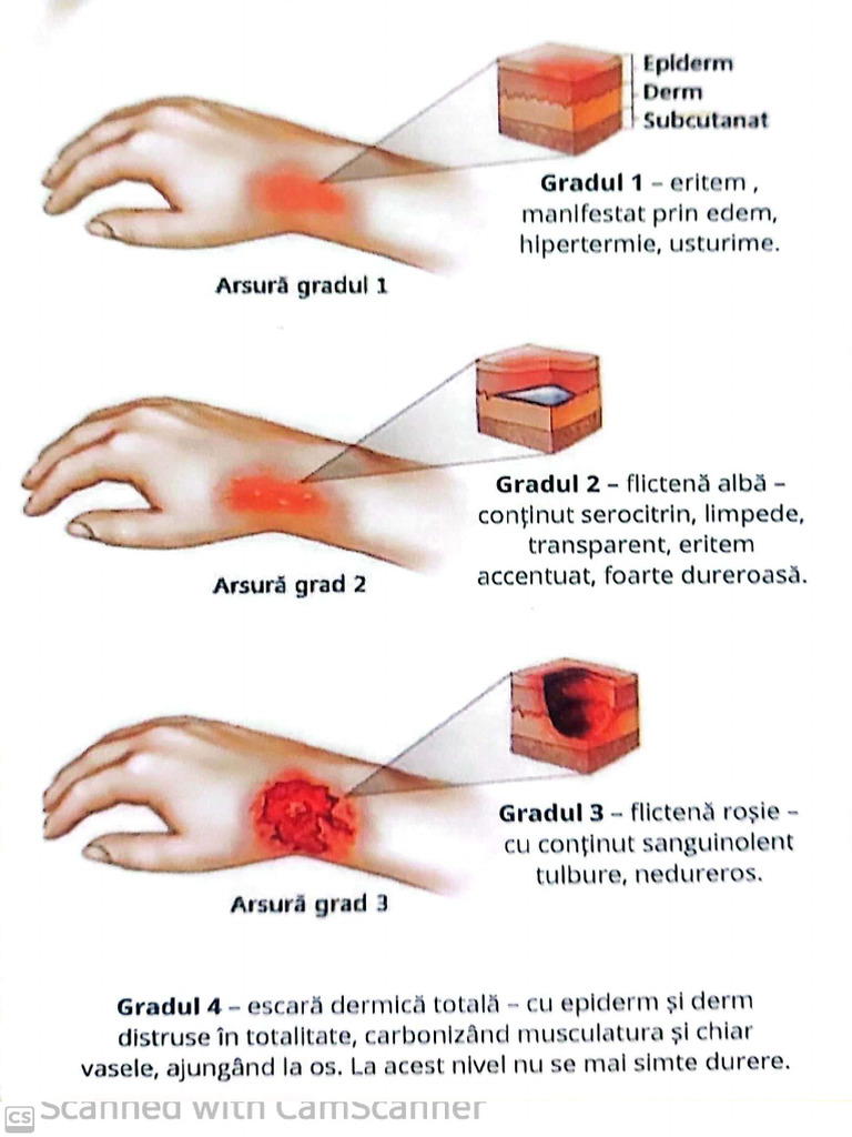 Grade de Arsura | PDF