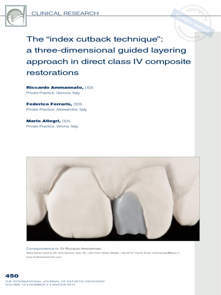 The “index cutback technique” a three-dimensional guided layering ...