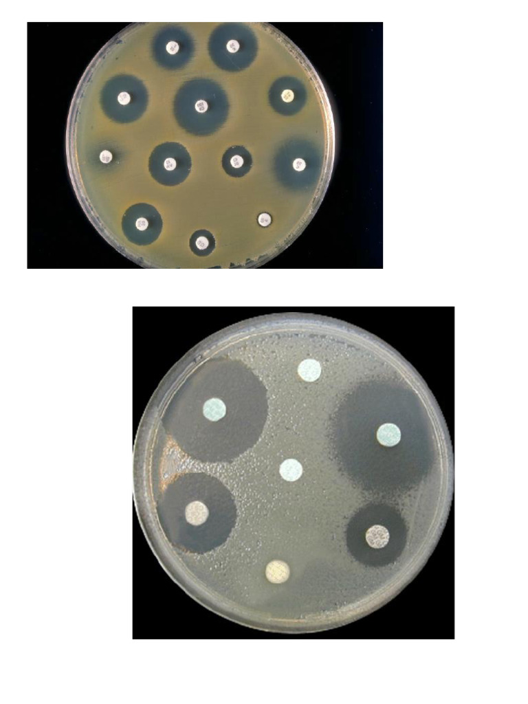Antibiograma | PDF