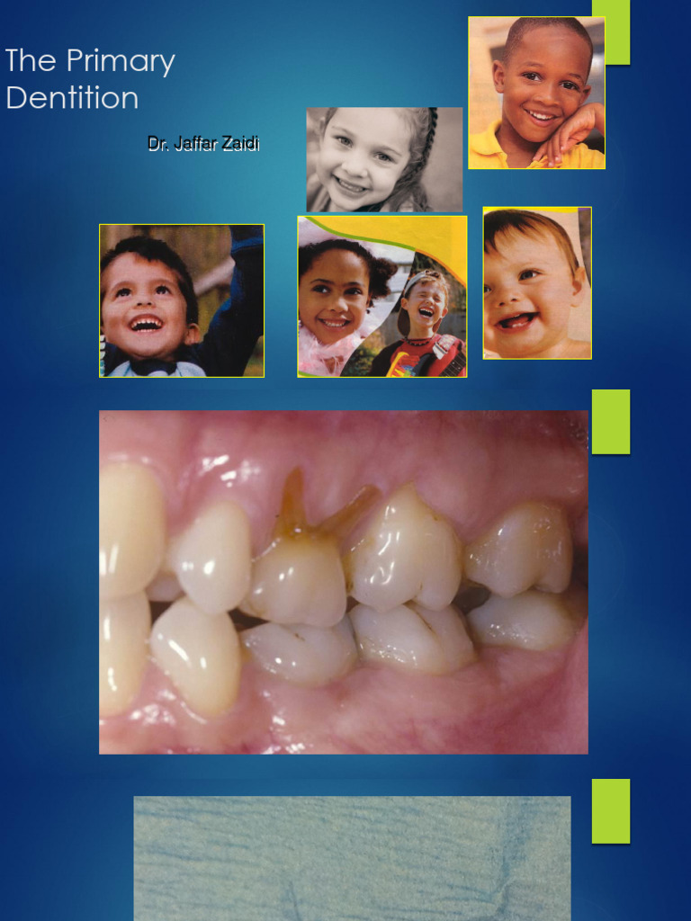 Primary Dentition | PDF