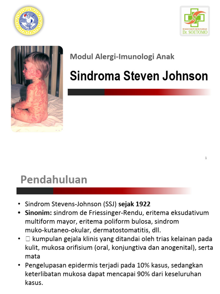Sindroma Steven Johnson - S | PDF