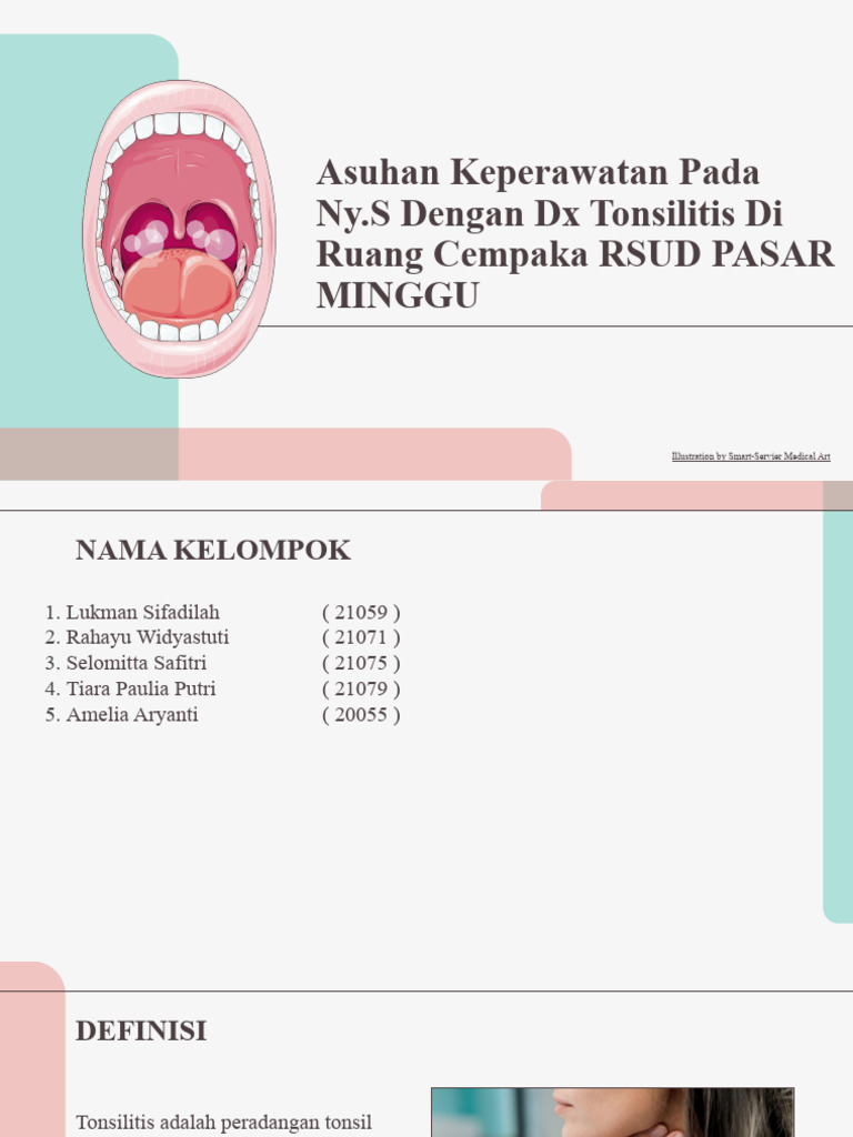 Ppt Kmb II Tonsilitis-1 | PDF