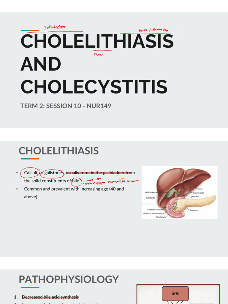 Session 10 Cholelithiasis and Cholecystitis 2 | PDF