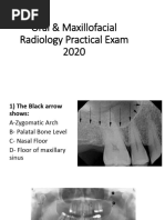 Sample Odontogram Description of Charting Symbols | PDF