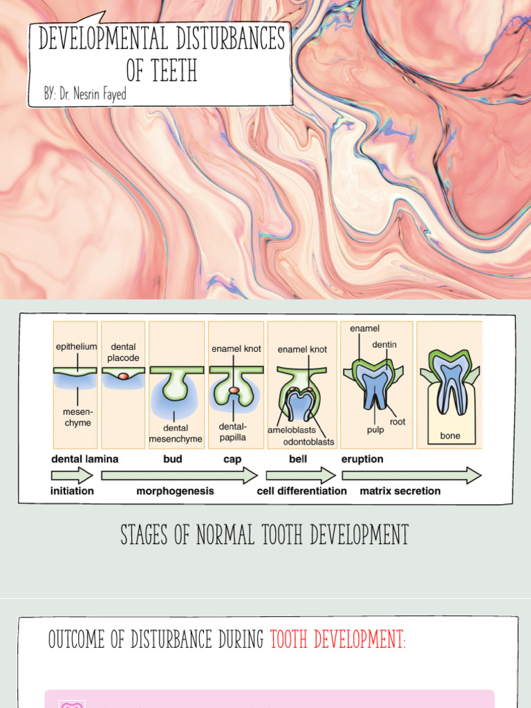 Developmental Disturbances of Teeth AIU PDF | PDF