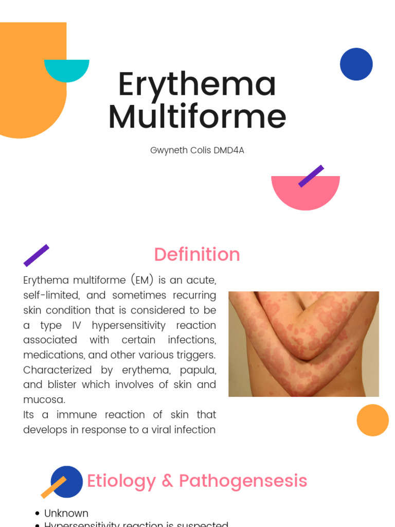 Erythema Multiforme | PDF | Medicine | Skin