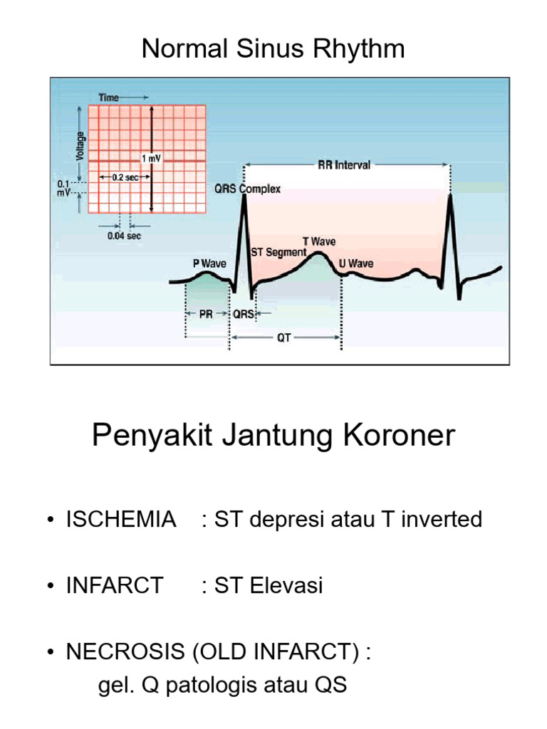 Code Blue - Ekg Dasar | PDF