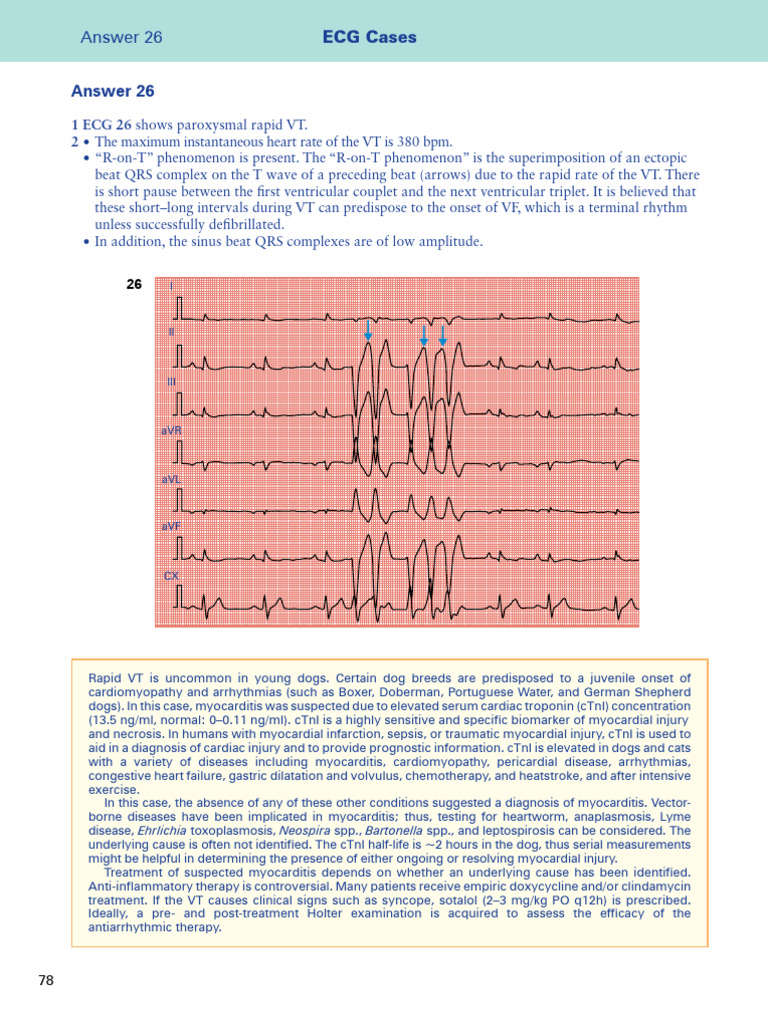ECG Cases Answer 26 | PDF