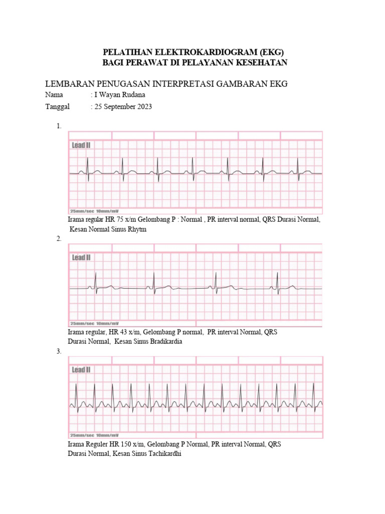 4. LEMBARAN PENUGASAN Interpretasi Gambaran EKG | PDF