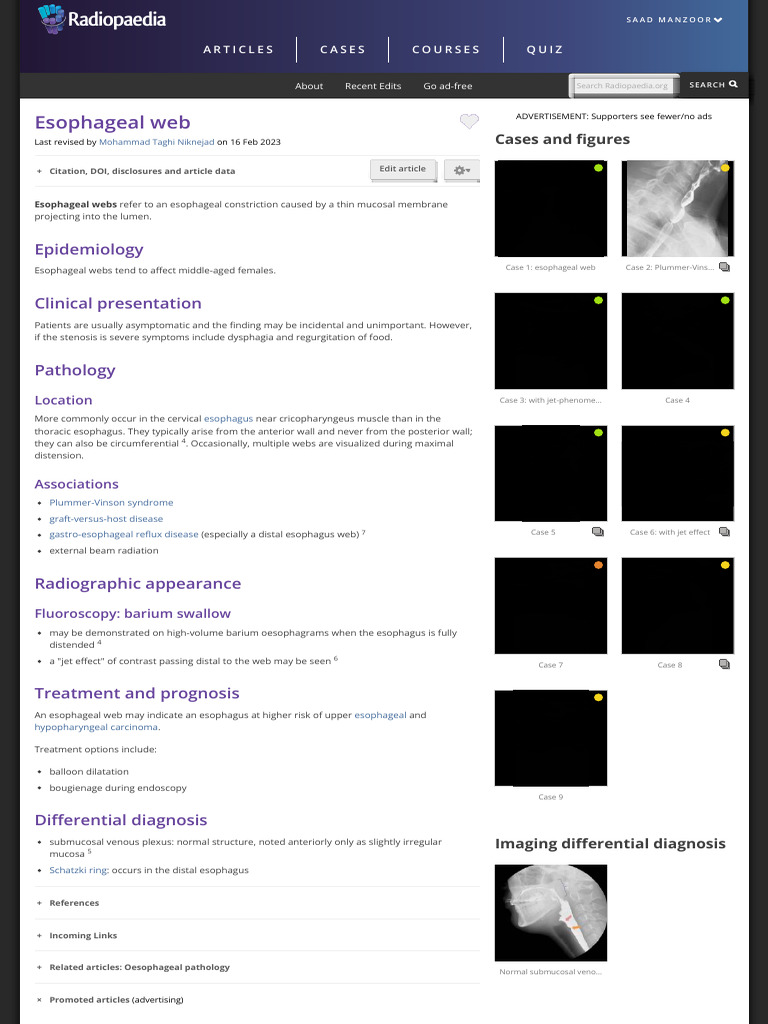 Esophageal Web Radiology Reference Article Ra | PDF