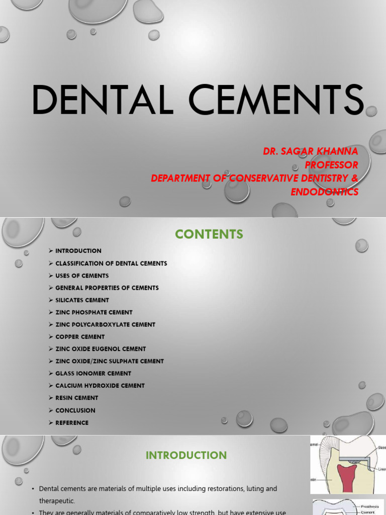 Classification of Dental Cements | PDF | Technology & Engineering