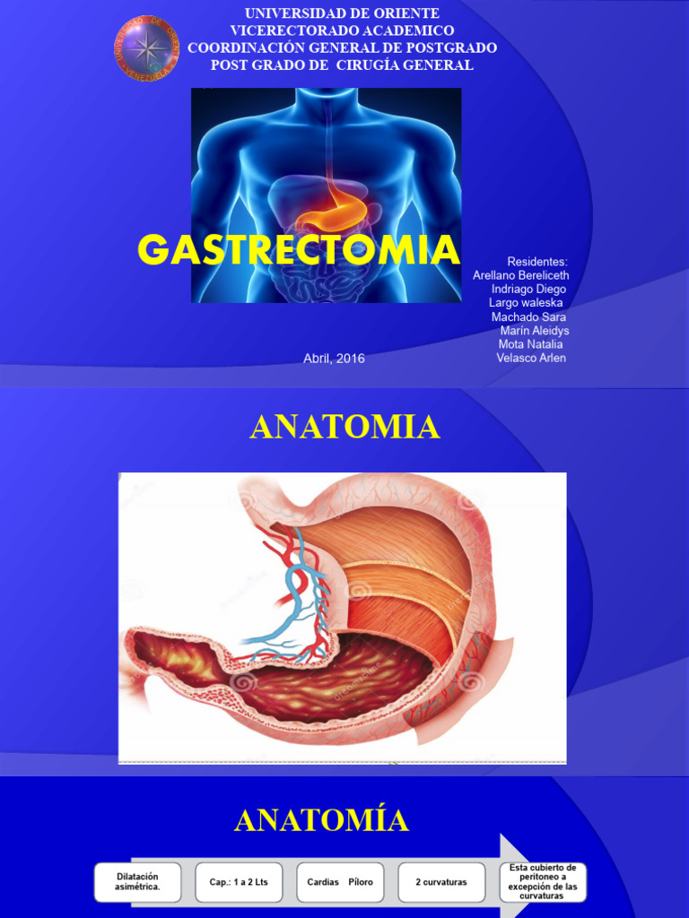 GASTRECTOMIA Genesis Murillo | PDF